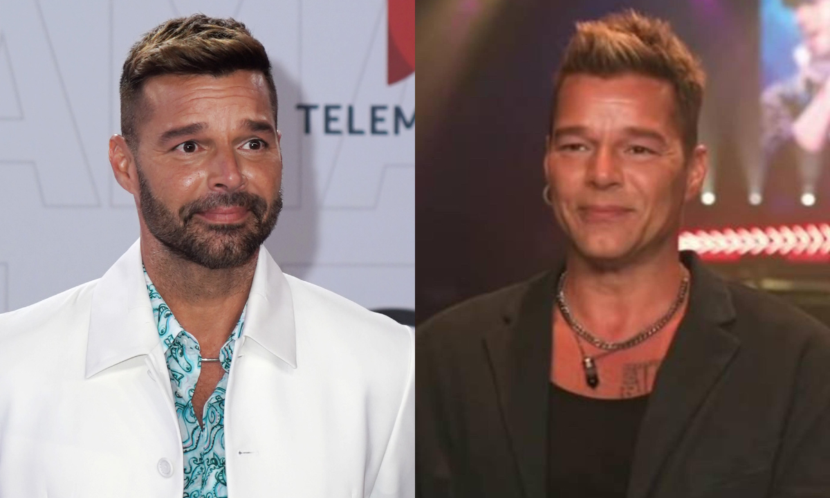 Harmonização?! Após surpreender público com aparência diferente em ...